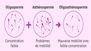 Oligospermie Traitement Naturel Solution Efficace Pour la Fertilités